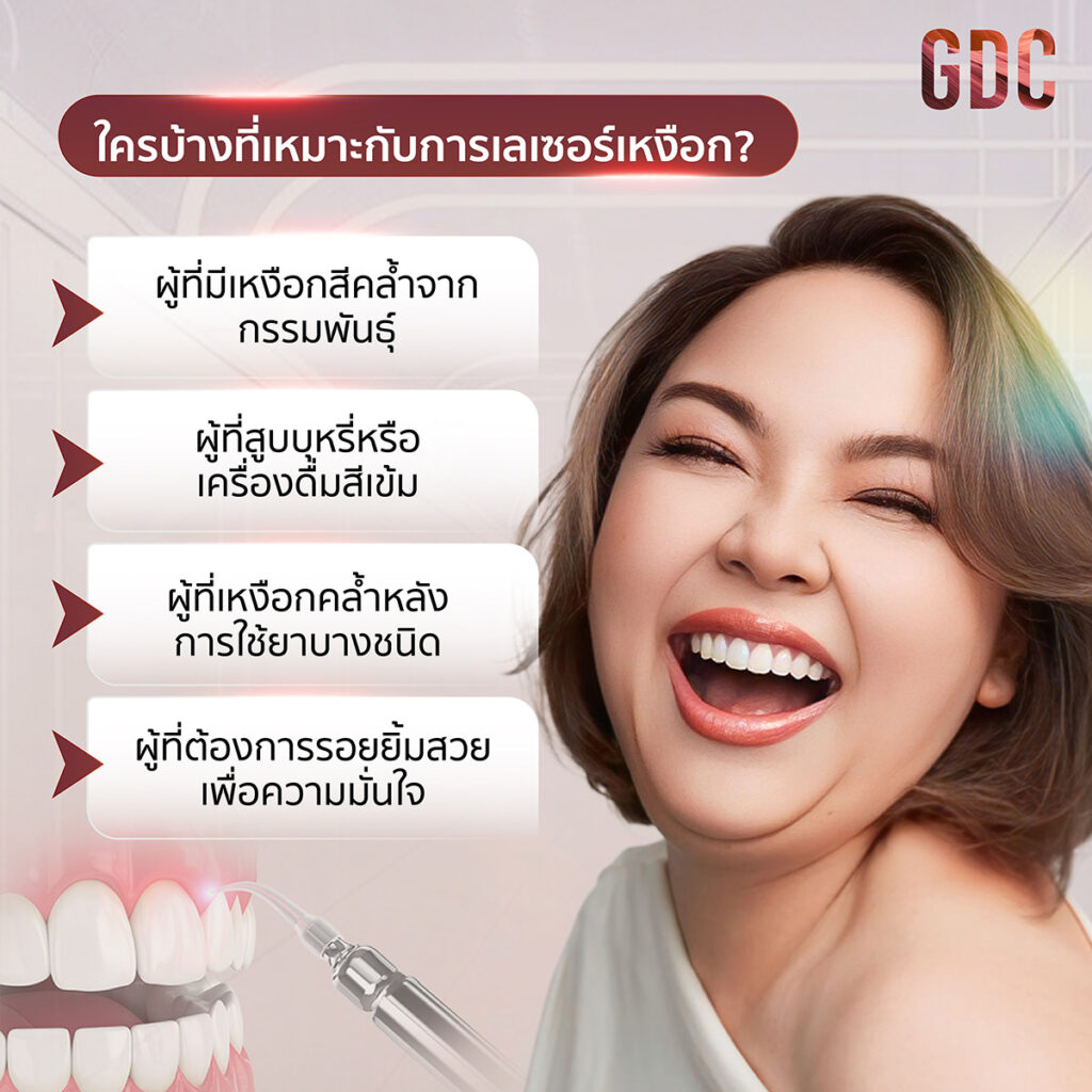เลเซอร์เหงือก (Gum Laser / Laser Gingival Bleaching)