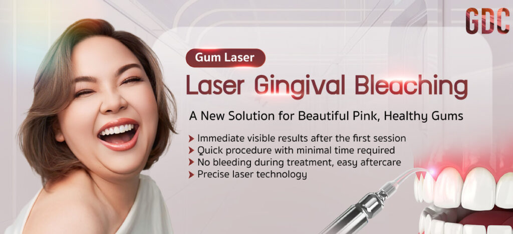 Gum Laser / Laser Gingival Bleaching
