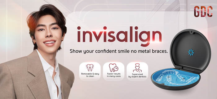 Invisalign - GDC Dental Clinic